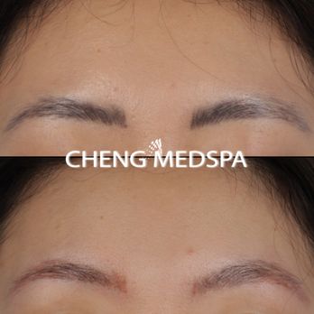CHENG PLASTIC SURGERY - Updated December 2025 - 153 Photos & 439 ...