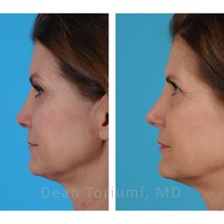 DEAN TORIUMI, MD - 47 Photos & 35 Reviews - 60 E Delaware Pl, Chicago ...