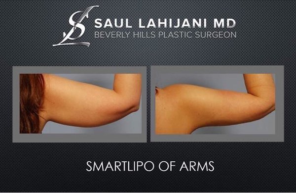 BEVERLY HILLS INSTITUTE OF PLASTIC SURGERY - Updated December 2025 ...