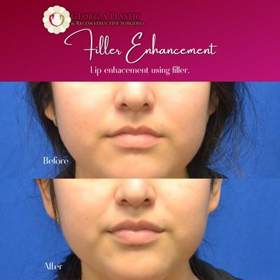 GEORGIA PLASTIC & RECONSTRUCTIVE SURGERY - 79 Photos & 30 Reviews ...