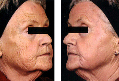 ADVANCED DERMATOLOGY - Updated October 2025 - 14 Photos & 64 Reviews ...