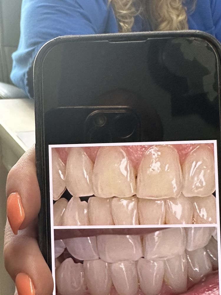 TEETH WHITENING CENTER - Updated January 2026 - 24 Photos & 10 Real Reviews - 125 S Main St ...