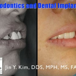 JIN Y. KIM - PERIODONTIST & DENTAL IMPLANT SURGEON - 41 Photos & 10 ...