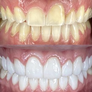 DENTAL DESIGN SMILE - Updated July 2025 - 41 Photos & 53 Reviews ...