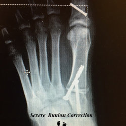 BEN TEHRANI, DPM - KINGS POINT FOOT & ANKLE - Updated July 2025 - 16 ...