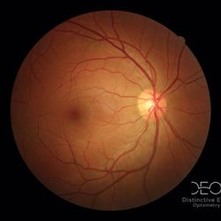 DISTINCTIVE EYES OPTOMETRY - 23 Photos & 14 Reviews - 1641 Colusa Hwy ...