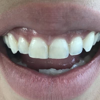 SMILES BY DESIGN - Updated October 2025 - 25 Photos & 130 Reviews ...