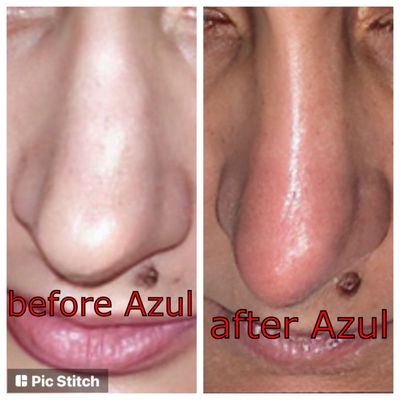 AZUL PLASTIC SURGERY - Updated January 2026 - 38 Photos & 22 Reviews ...