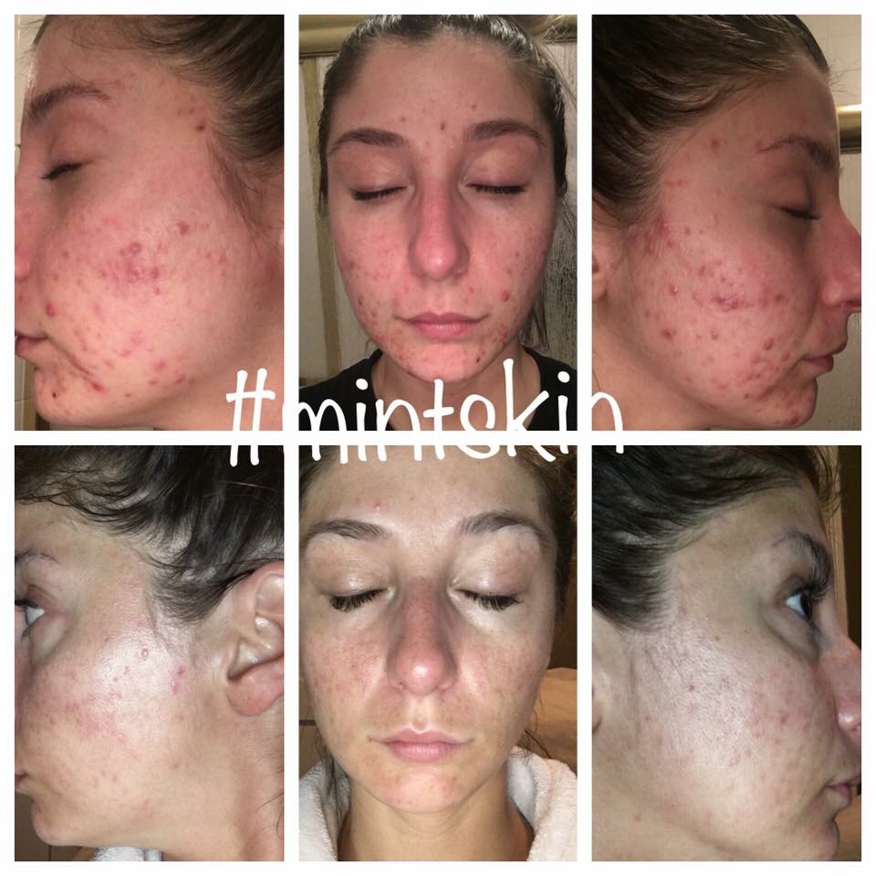 MINT SKIN - Updated July 2025 - 12 Photos - 8 Amity St, Spencerport ...