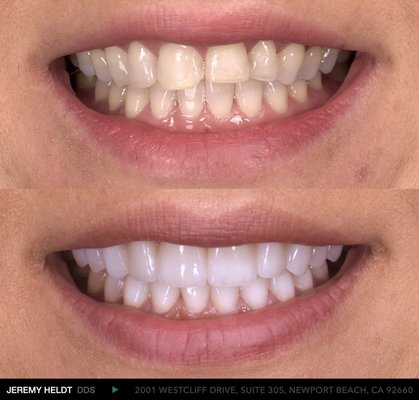 JEREMY HELDT, DDS - Updated May 2025 - 222 Photos & 104 Reviews - 2001 ...