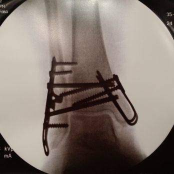 TSAOG ORTHOPAEDICS-QUARRY AREA - Updated January 2026 - 20 Photos & 56 ...