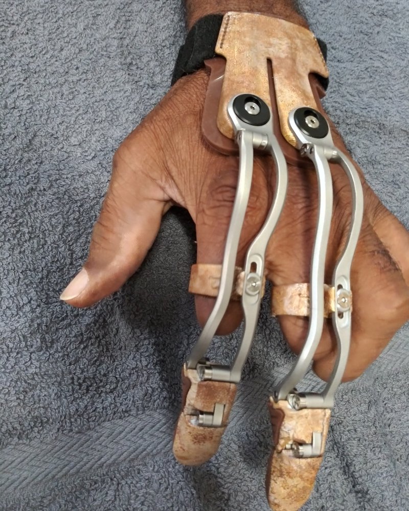 FLORIDA HAND TEAM & ASSOCIATES - Updated January 2025 - 25 Photos ...