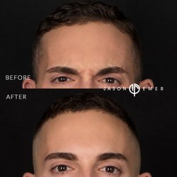 JASON EMER, MD - 995 Photos & 386 Reviews - 9201 Sunset Blvd, West ...