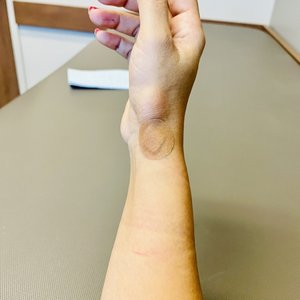 PROLIANCE ORTHOPAEDICS & SPORTS MEDICINE - ISSAQUAH - Updated July 2025 ...