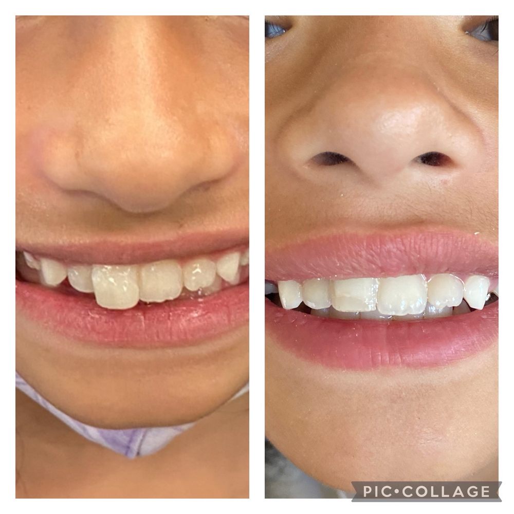 BAY AREA ENDODONTICS - Updated December 2025 - 71 Reviews - 990 W ...