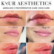 COLLER J OCHSNER, MD - Updated November 2025 - 16 Reviews - 2323 ...