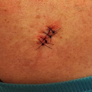 PIH HEALTH DERMATOLOGY - WHITTIER - Updated December 2025 - 15 Reviews ...