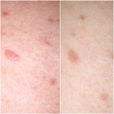 JOHN A. KASCH, MD - Updated July 2024 - 14 Photos & 73 Reviews - 3011 O ...