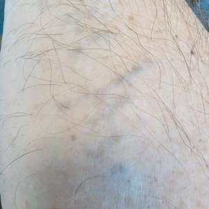 MIDWEST IMAGING/MRI OF SPRINGFIELD - Updated May 2025 - 11 Photos ...