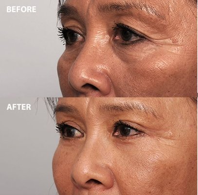 DAVID CHO, MD - Updated December 2025 - 36 Photos & 42 Reviews - 888 S ...