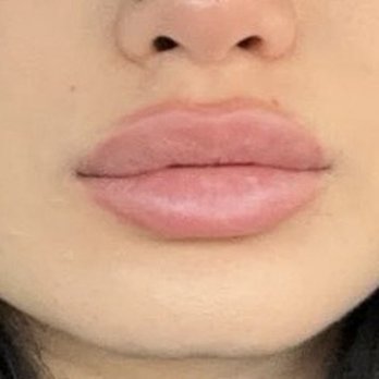 SYNERCHI MEDICAL SPA - Updated July 2025 - 98 Photos & 352 Reviews ...