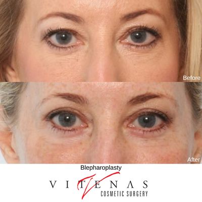 VITENAS COSMETIC SURGERY - 177 Photos & 66 Reviews - 4208 Richmond Ave ...