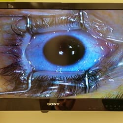 RANCHO LASER VISION CENTER - 31 Photos & 133 Reviews - Ophthalmologists ...