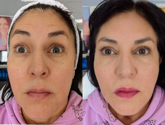 REJUV MEDICAL - Updated March 2025 - 32 Photos & 38 Reviews - 255 King ...