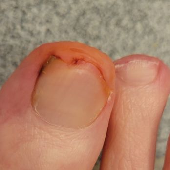 PA FOOT & ANKLE ASSOCIATES - Updated December 2025 - 11 Photos & 28 ...