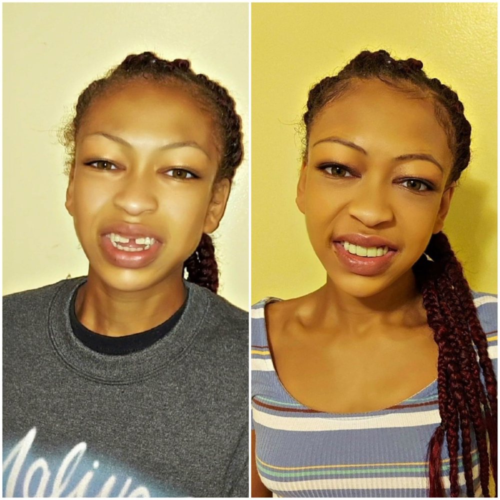 UPPER DARBY FAMILY DENTAL - Updated October 2024 - 13 Photos - 7922 ...