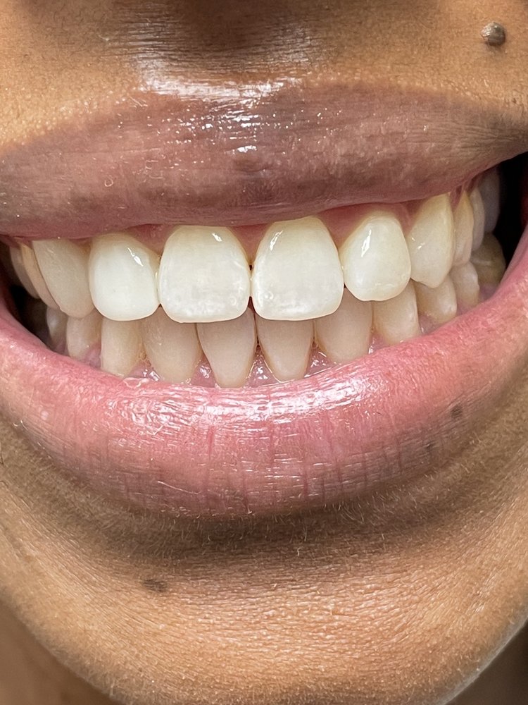 TANIA BAKER, DDS - CALABASAS DENTAL SPA - Updated January 2026 - 33 ...