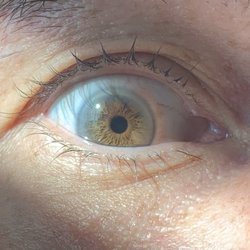 NVISION EYE CENTERS - NEWPORT BEACH - 79 Photos & 689 Reviews - 4220 ...