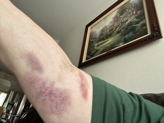 BIOLIFE PLASMA SERVICES - Updated August 2025 - 61 Photos & 240 Reviews ...