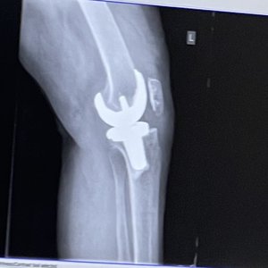 JONATHAN D GELBER MD, MS - LA ORTHO AND WELLNESS - Updated December ...