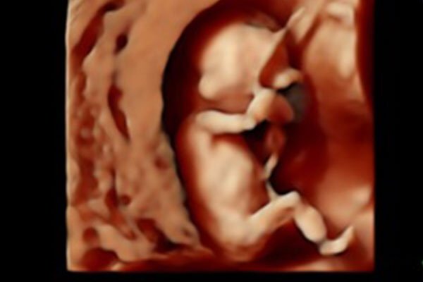 BUNDLE OF JOY HD - Updated November 2025 - 16 Photos - 285 SE Inner Lp ...