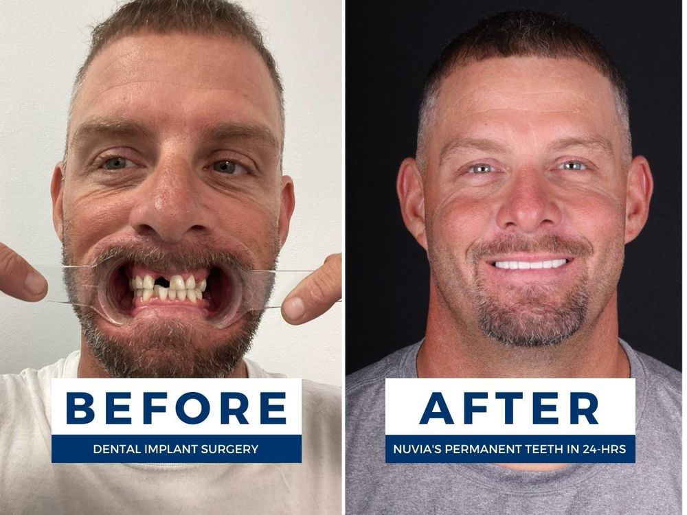 NUVIA DENTAL IMPLANT CENTER - SOUTH MIAMI - Updated September 2025 - 17 ...