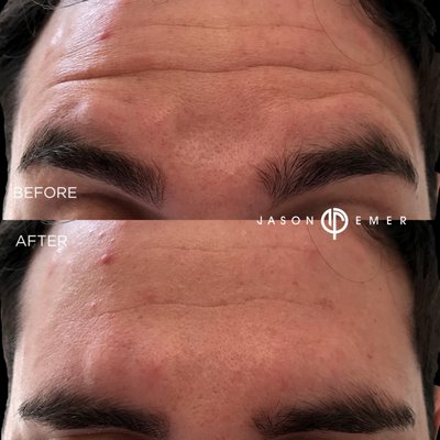 JASON EMER, MD - 997 Photos & 407 Reviews - 9201 Sunset Blvd, West ...