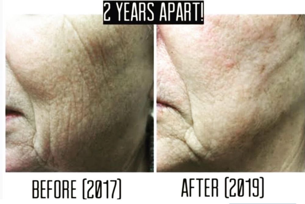 DREW VARANO, MD - 12 Photos & 31 Reviews - Cosmetic Surgeons - 2311 M ...