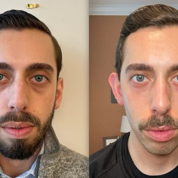 JASON EMER, MD - Updated July 2025 - 1158 Photos & 512 Reviews - 9201 ...