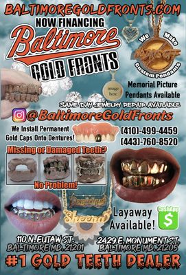BALTIMORE GOLD FRONTS - Request a Quote - 65 Photos - 110 N Eutaw St ...