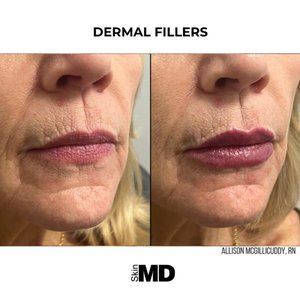 ASPIRE DERMATOLOGY - Updated September 2025 - 1524 Atwood Ave, Johnston ...