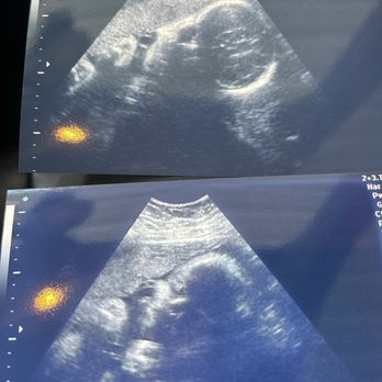 FETAL MEMORIES 2D 3D 4D ULTRASOUND - Updated April 2025 - 150 Photos ...