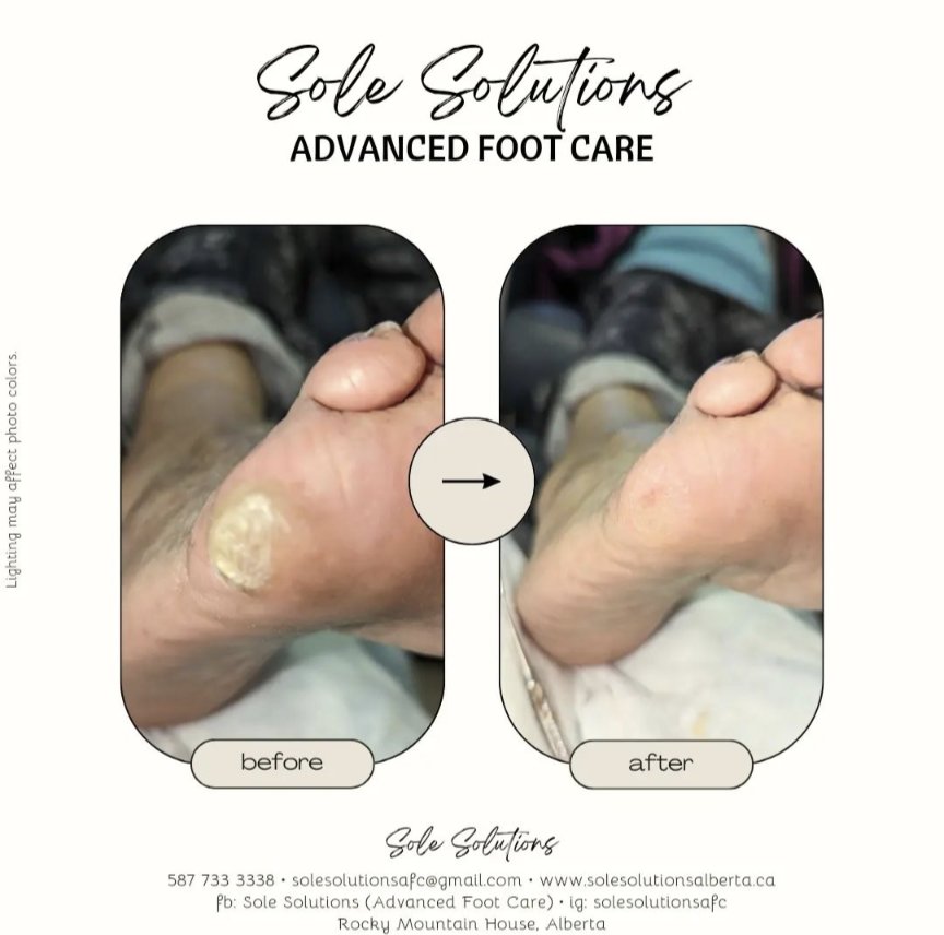 SOLE SOLUTIONS - Updated December 2025 - 10 Photos - Rocky Mountain House, Alberta - Medical ...