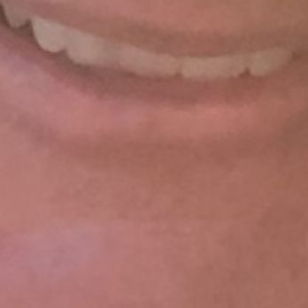 ORLY TAITZ, DDS - Updated December 2025 - 43 Photos & 77 Reviews ...