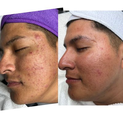 UNBLEMISHED SKIN STUDIO - Updated December 2025 - 100 Photos & 15 ...