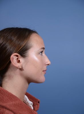 Dallas Rhinoplasty Center: C. Spencer Cochran MD - Updated June 2026 ...