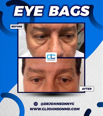 CHRISTOPHER L JOHNSON, MD FACS - Updated December 2025 - 31 Photos & 16 ...