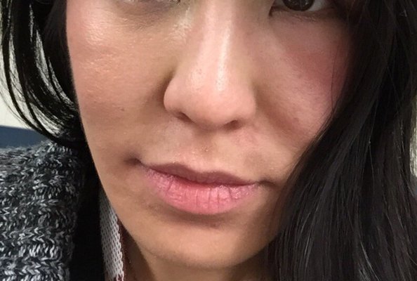 LINDA LI, MD, FACS - Updated July 2025 - 36 Photos & 151 Reviews - 433 ...