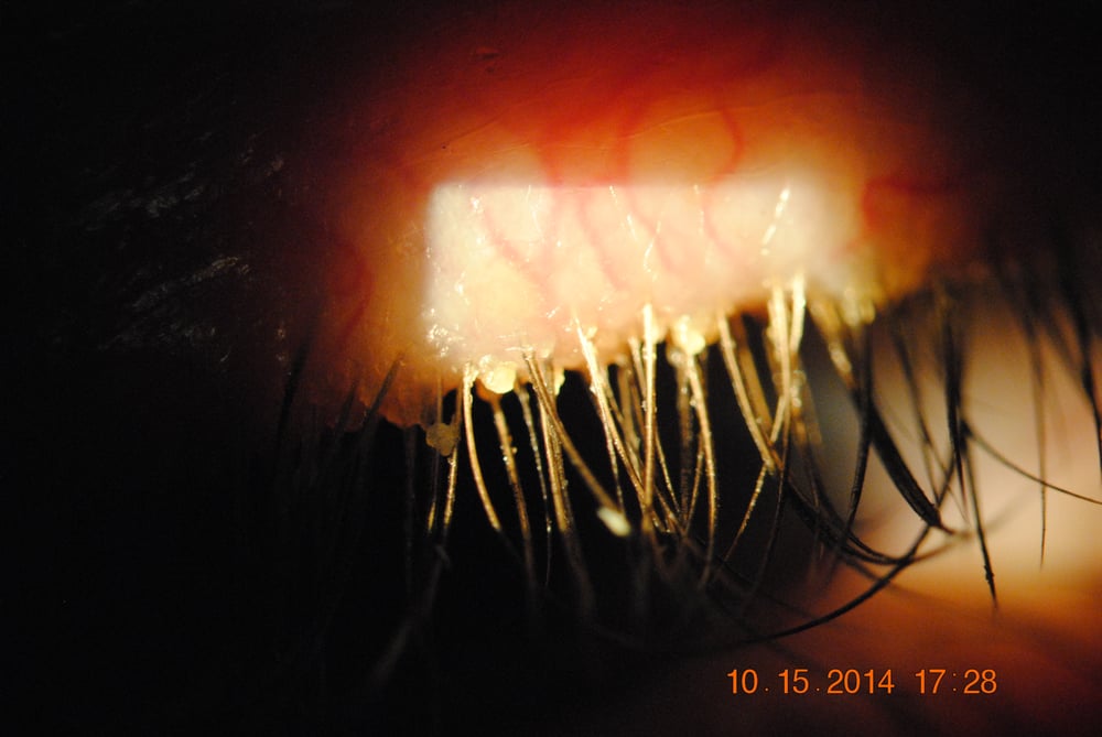 COLIN R BERNSTEIN, OD - Updated November 2025 - 9834 Genesee Ave, La ...