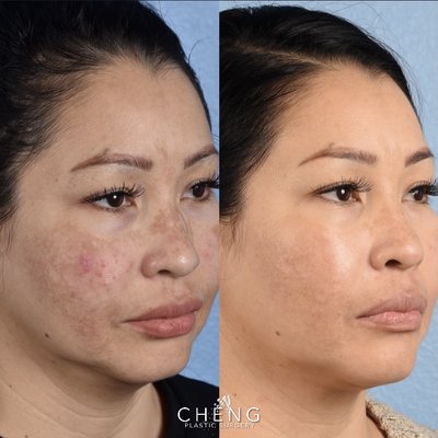 CHENG PLASTIC SURGERY - Updated January 2026 - 153 Photos & 441 Reviews ...